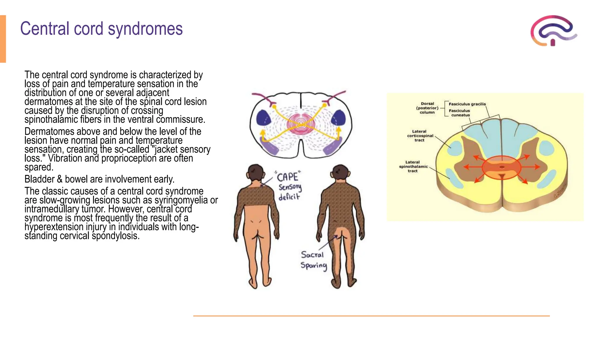 spinal cord disorders and paraplegia . | PPTX