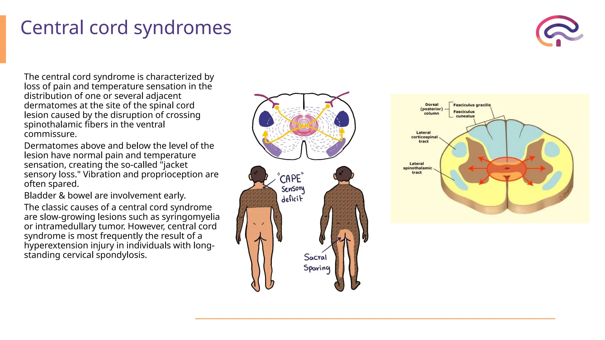 spinal cord disorders (Myelopathies and radiculoapthies) | PPTX