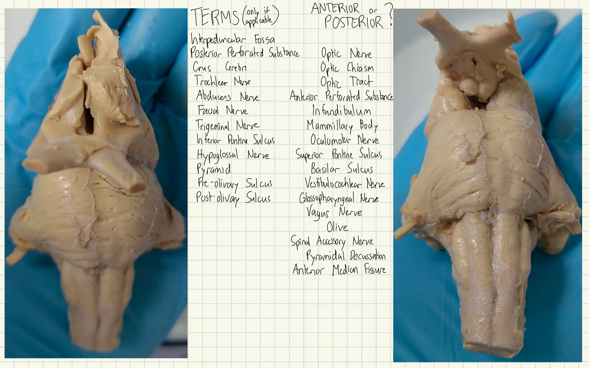 Spinal Cord and Brainstem Practice go go pdf | PPT