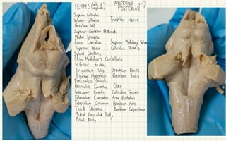 Spinal Cord and Brainstem Practice go go pdf | PPT