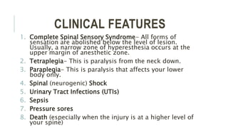 spinal cord anushka.pptx - BY ANUSHKA - MBBS 1ST YR | PPTX