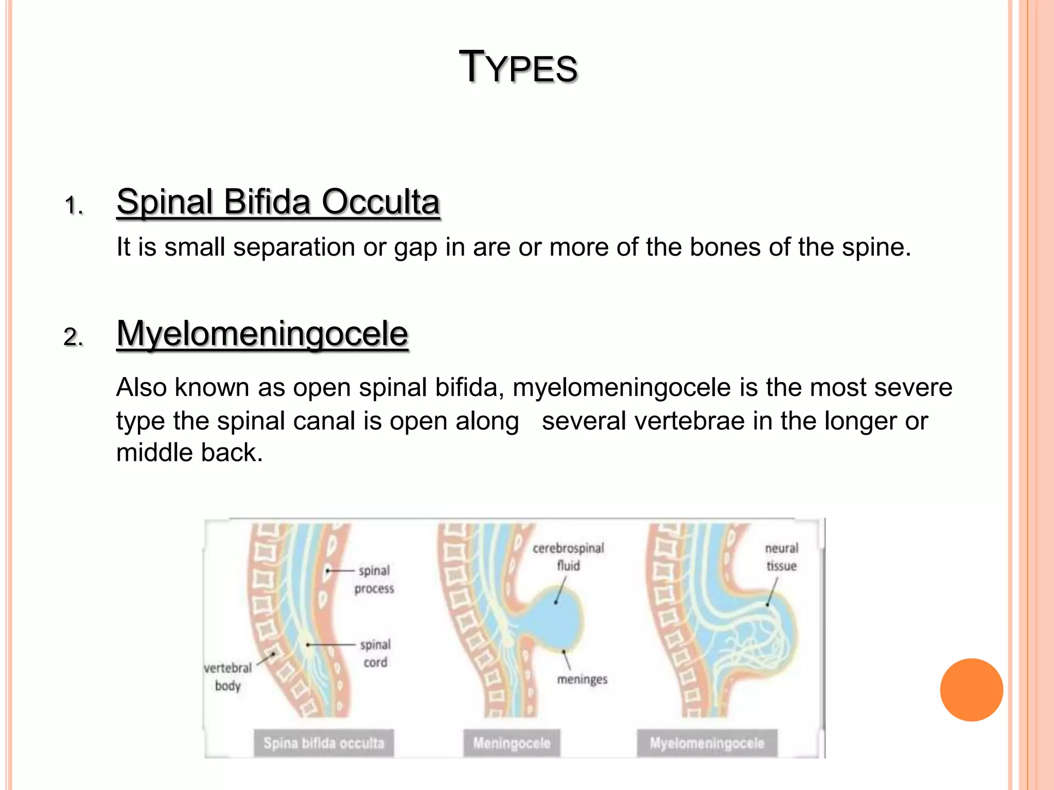 Spinal cord disorders | PPTX