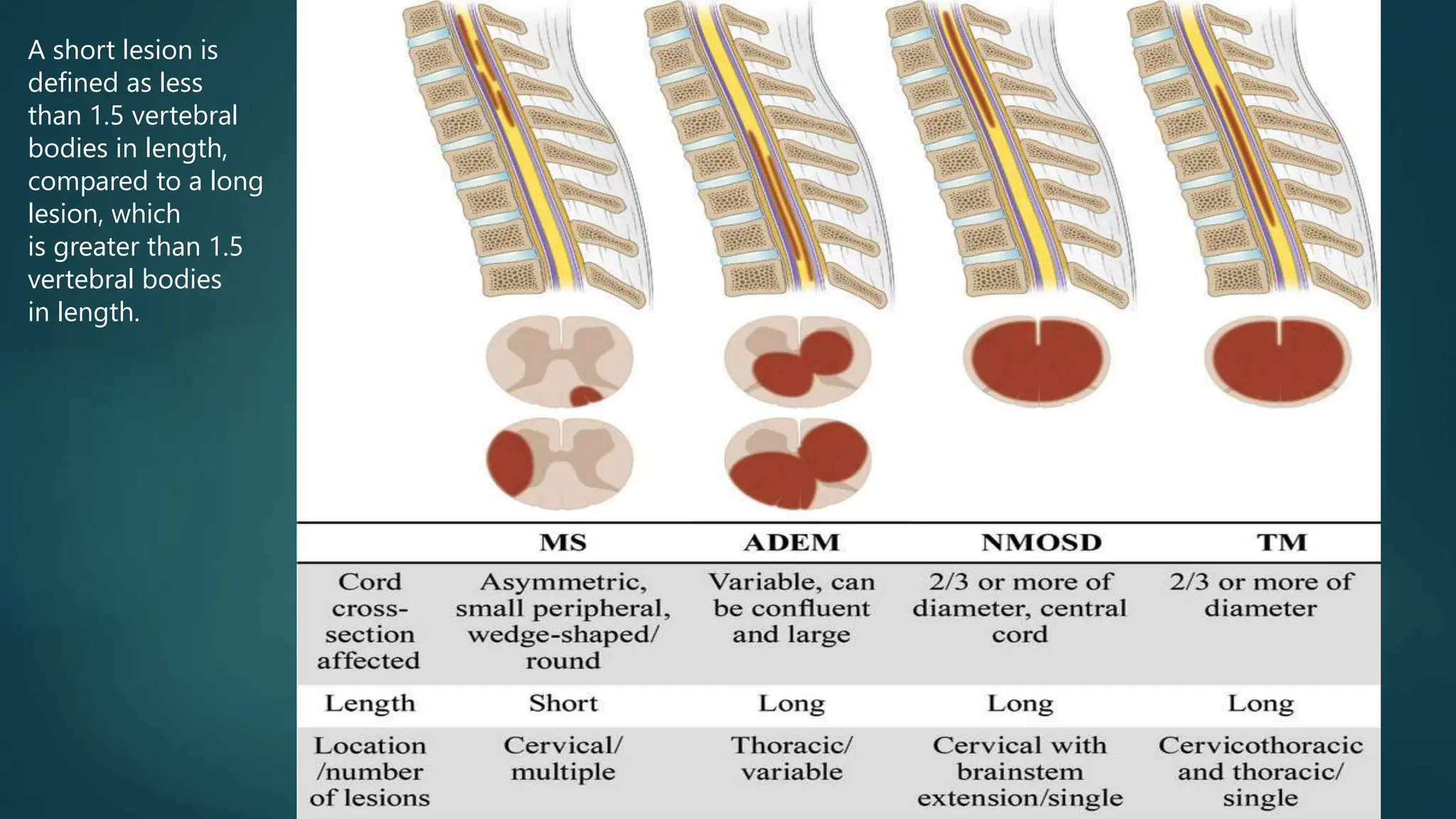 SPINAL CORD DISORDERS.pptx