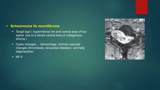 SPINAL CORD DISORDERS.pptx