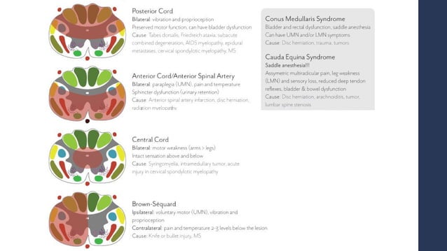 Spinal Cord Disease - Clinical Presentations and Management | PDF