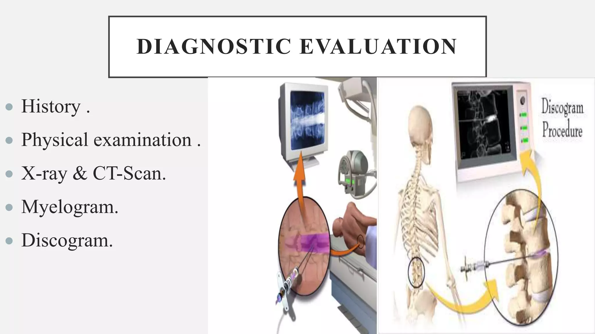 SPINAL CORD HERNIATION.pptx