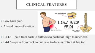 SPINAL CORD HERNIATION.pptx
