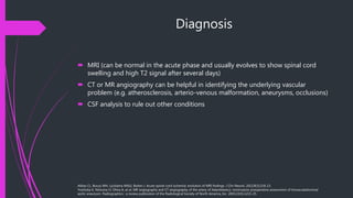 Spinal Cord Infarction | PPTX