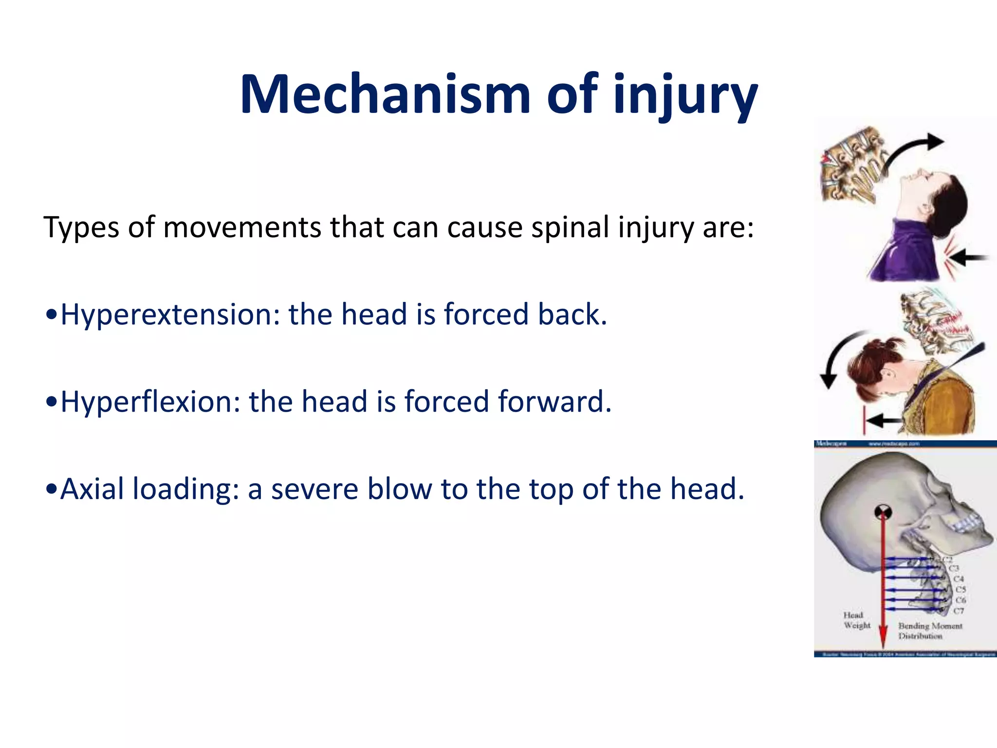 Spinal cord injuries | PPTX