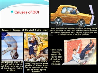 Spinal cord injuries | PPT