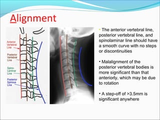 Spinal cord injuries | PPT