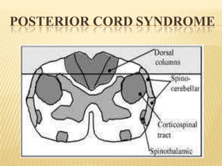 Spinal Cord Injuries.pptx