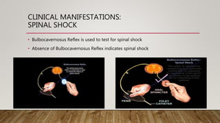 Bulbocavernosus Reflex