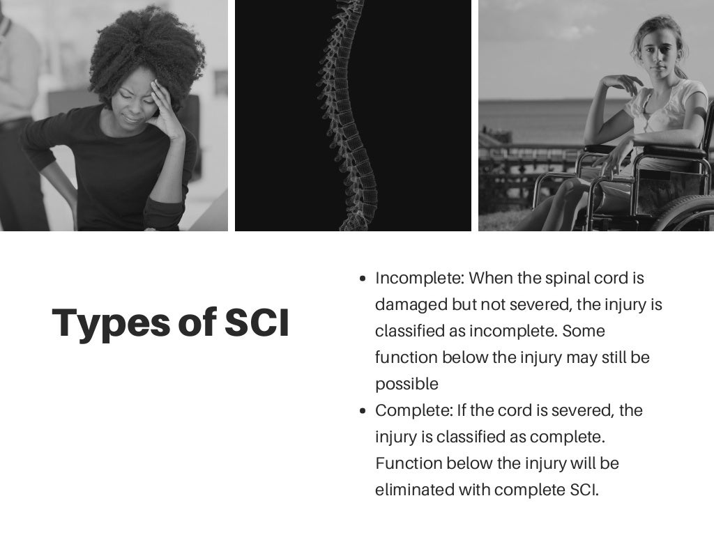 Spinal Cord Injury: Causes, Treatment, Prognosis | PDF