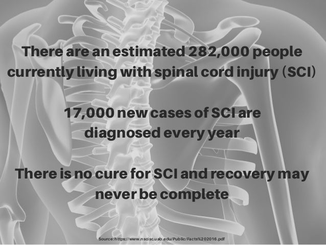 Spinal Cord Injury: Causes, Treatment, Prognosis | PPT