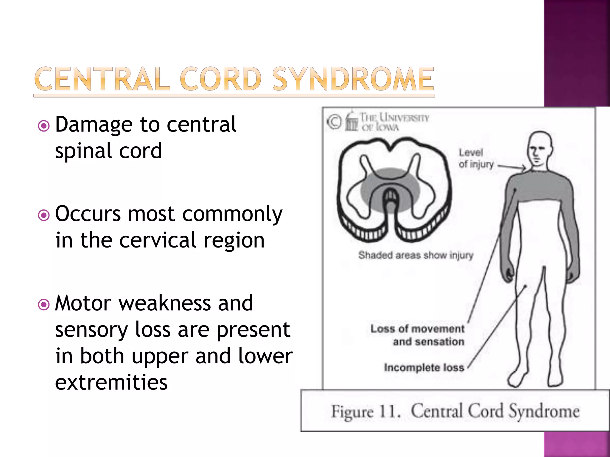 Spinal cord injury | PPTX