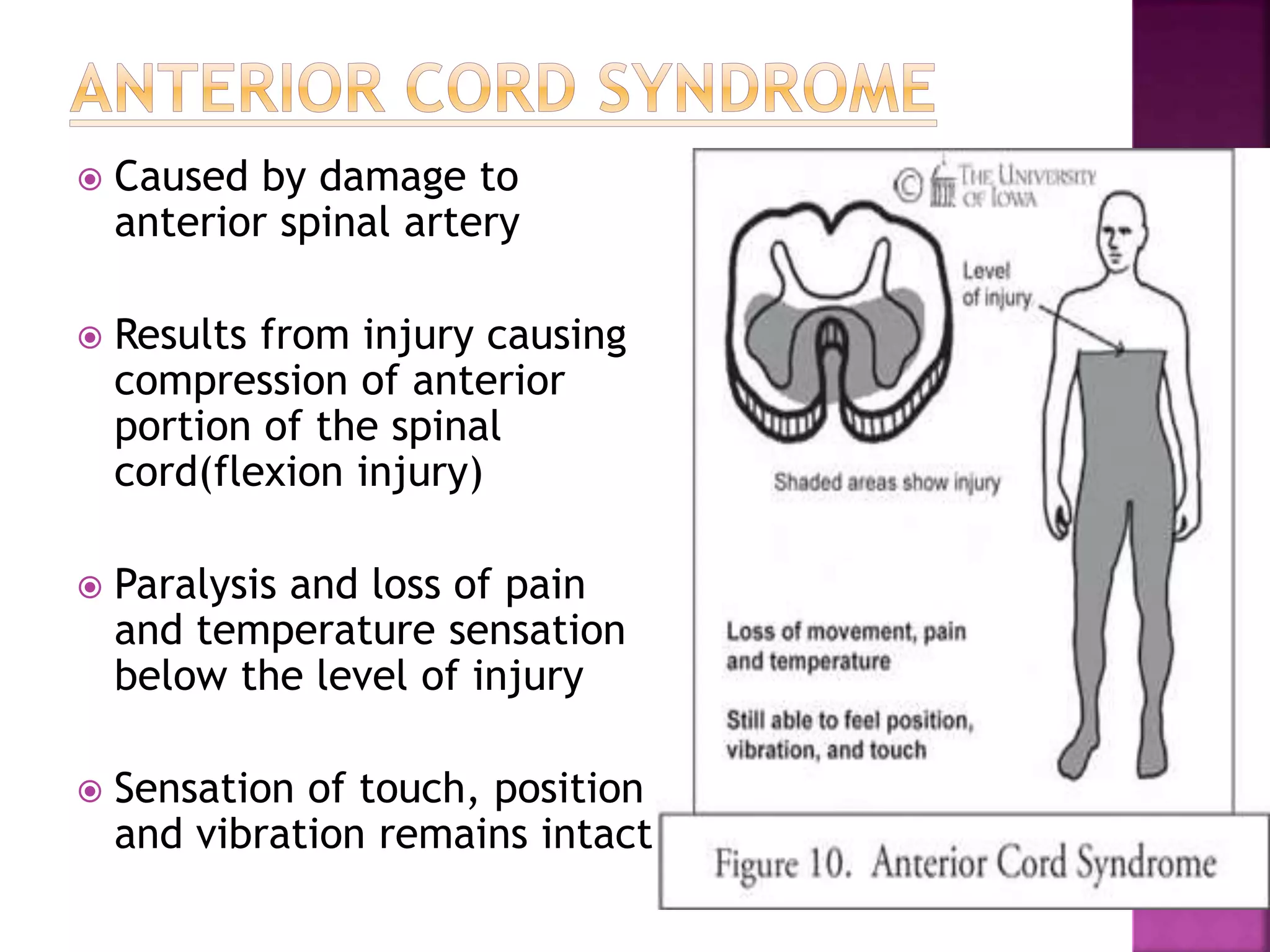 Spinal cord injury | PPTX