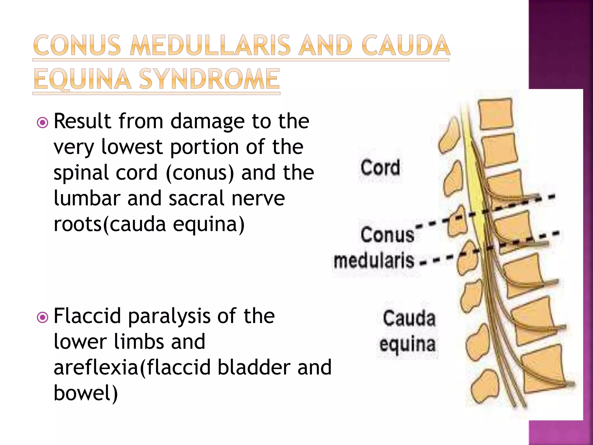 Spinal cord injury | PPTX