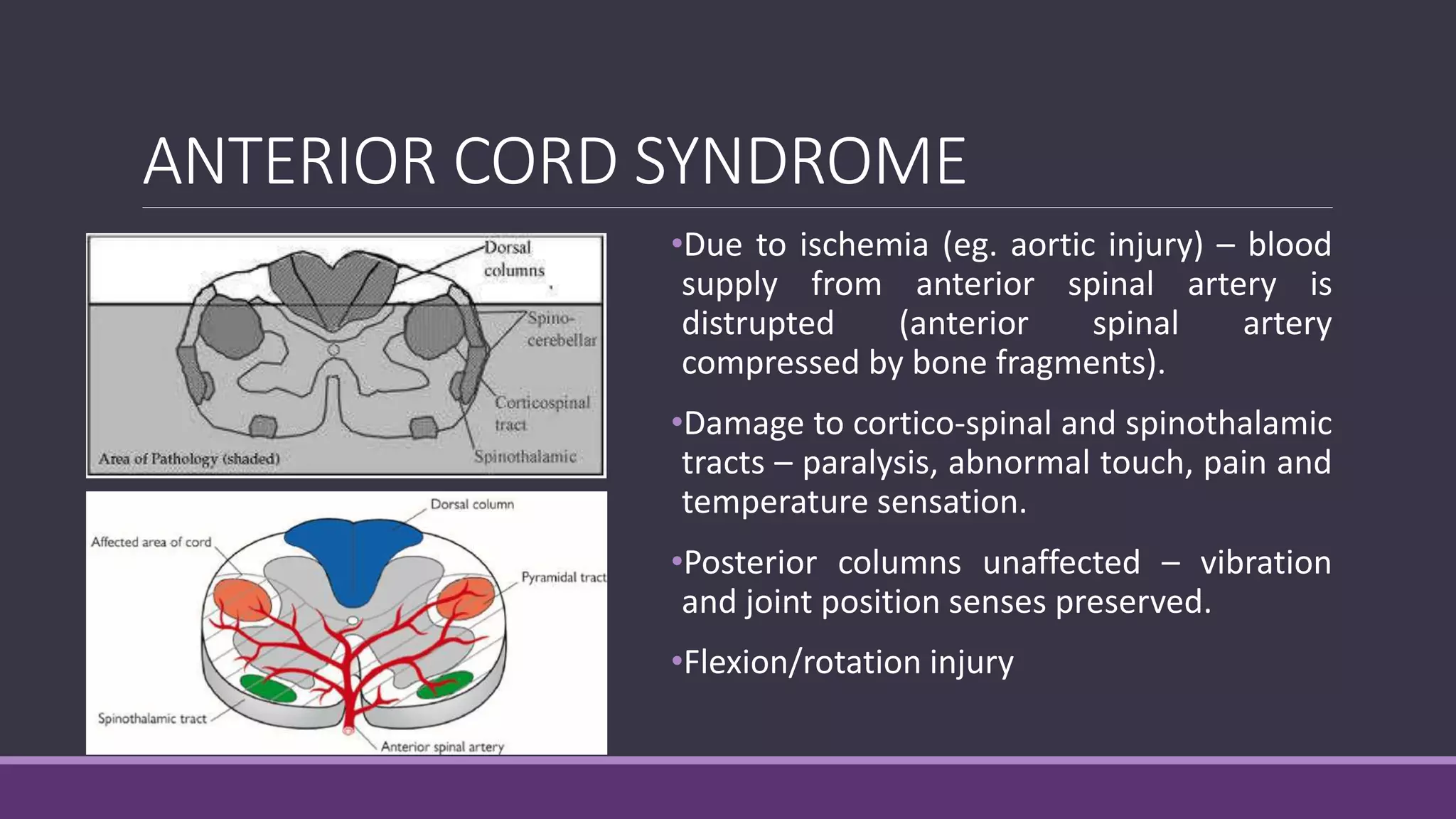 Spinal cord injury | PPTX