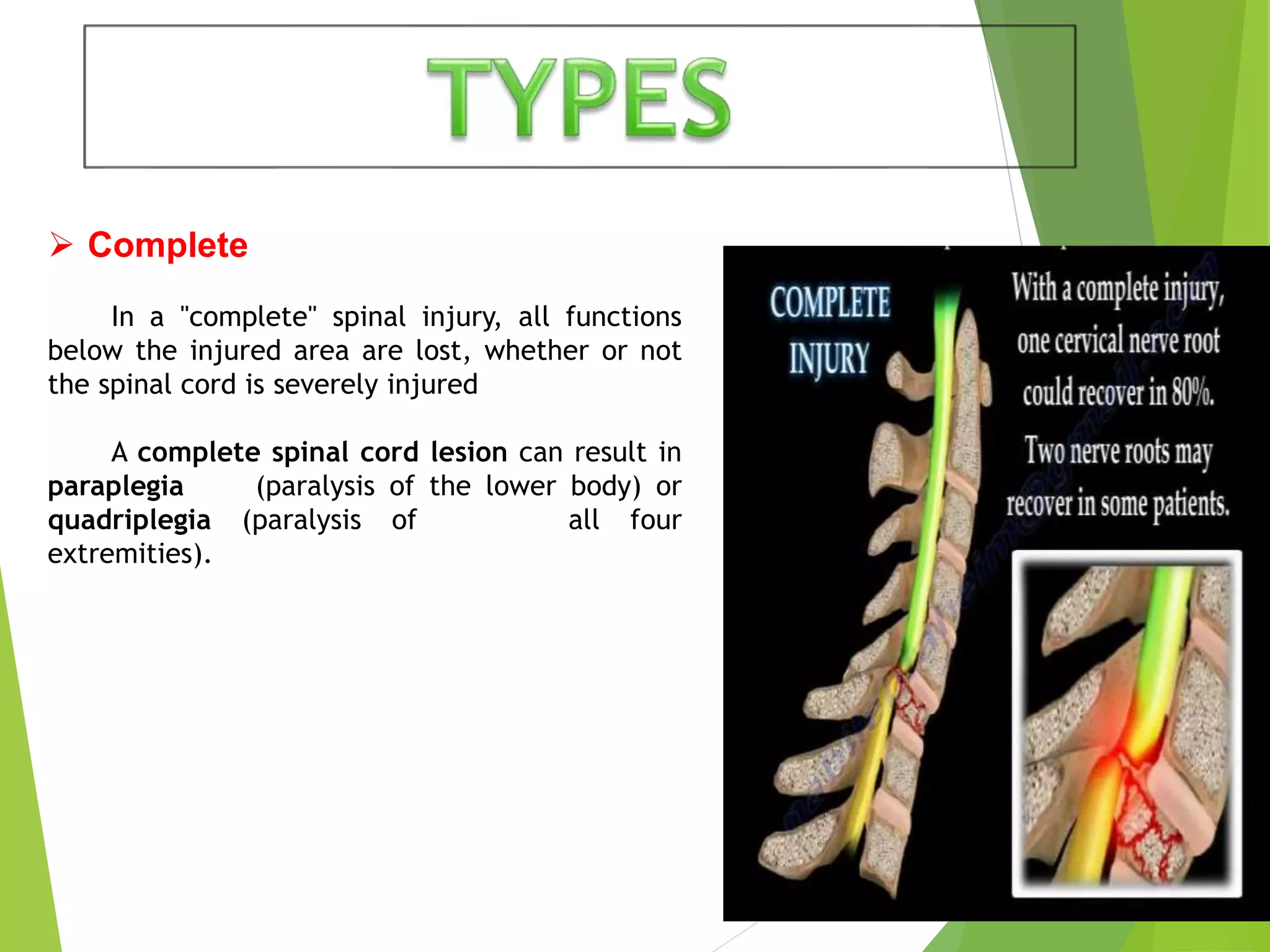 Spinal Cord Injury | PPTX