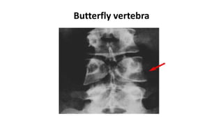 Spinal cord injury | PPTX
