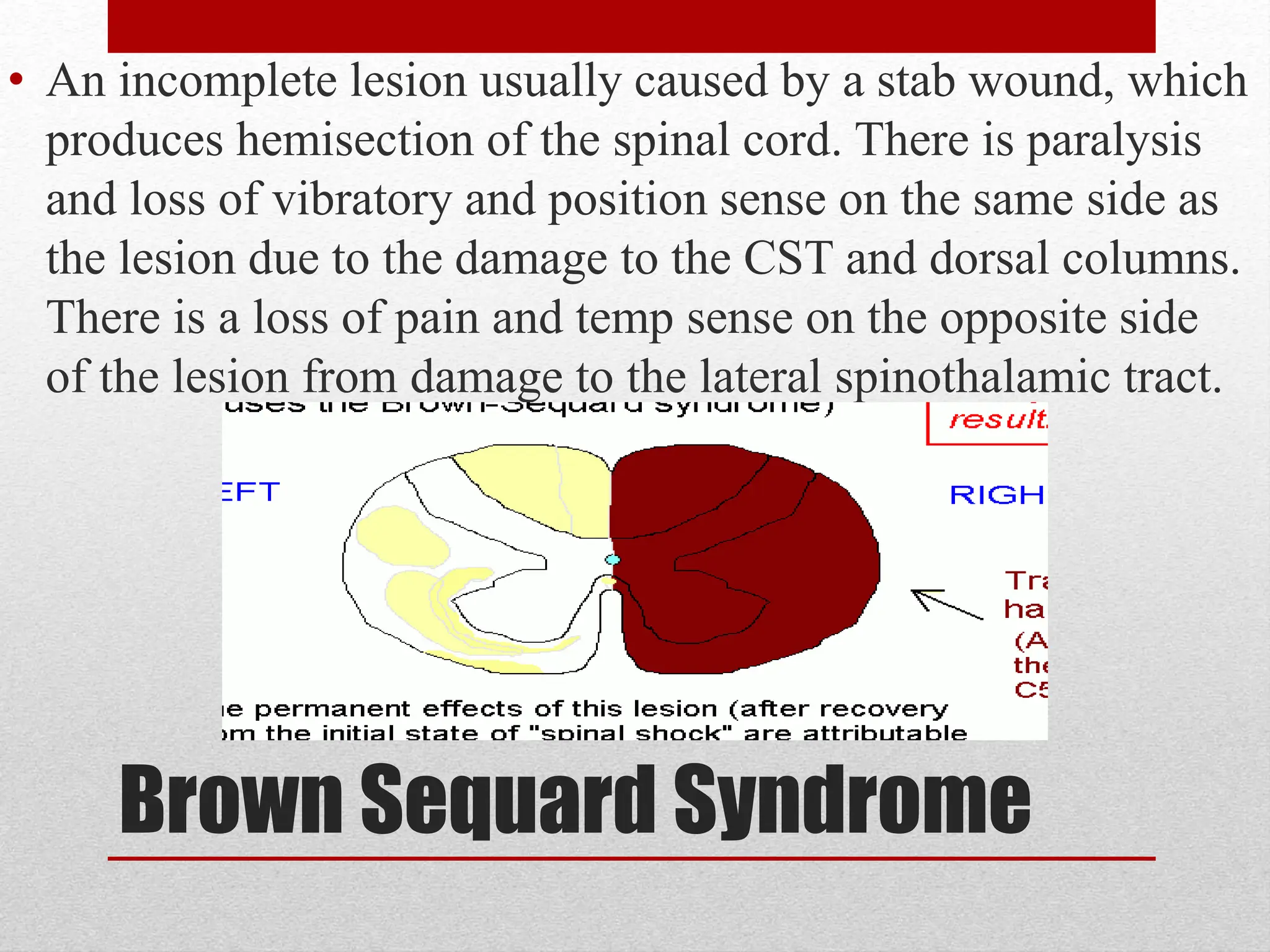 Spinal cord anatomy and injury in human beings | PPTX