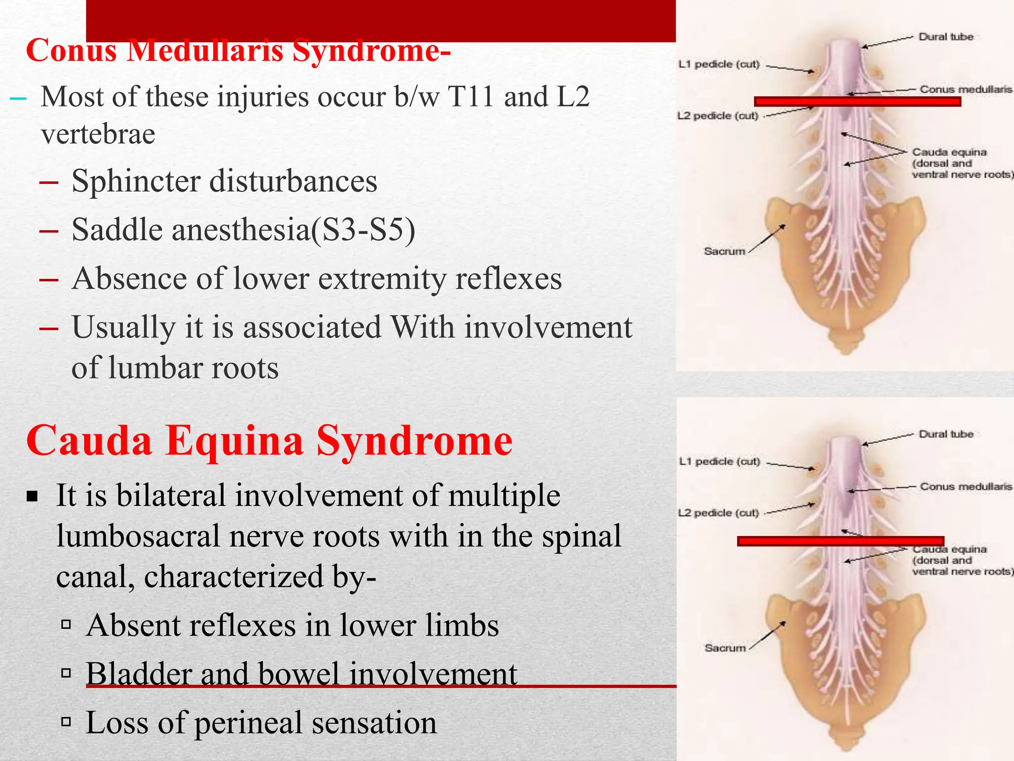 Spinal cord anatomy and injury in human beings | PPTX