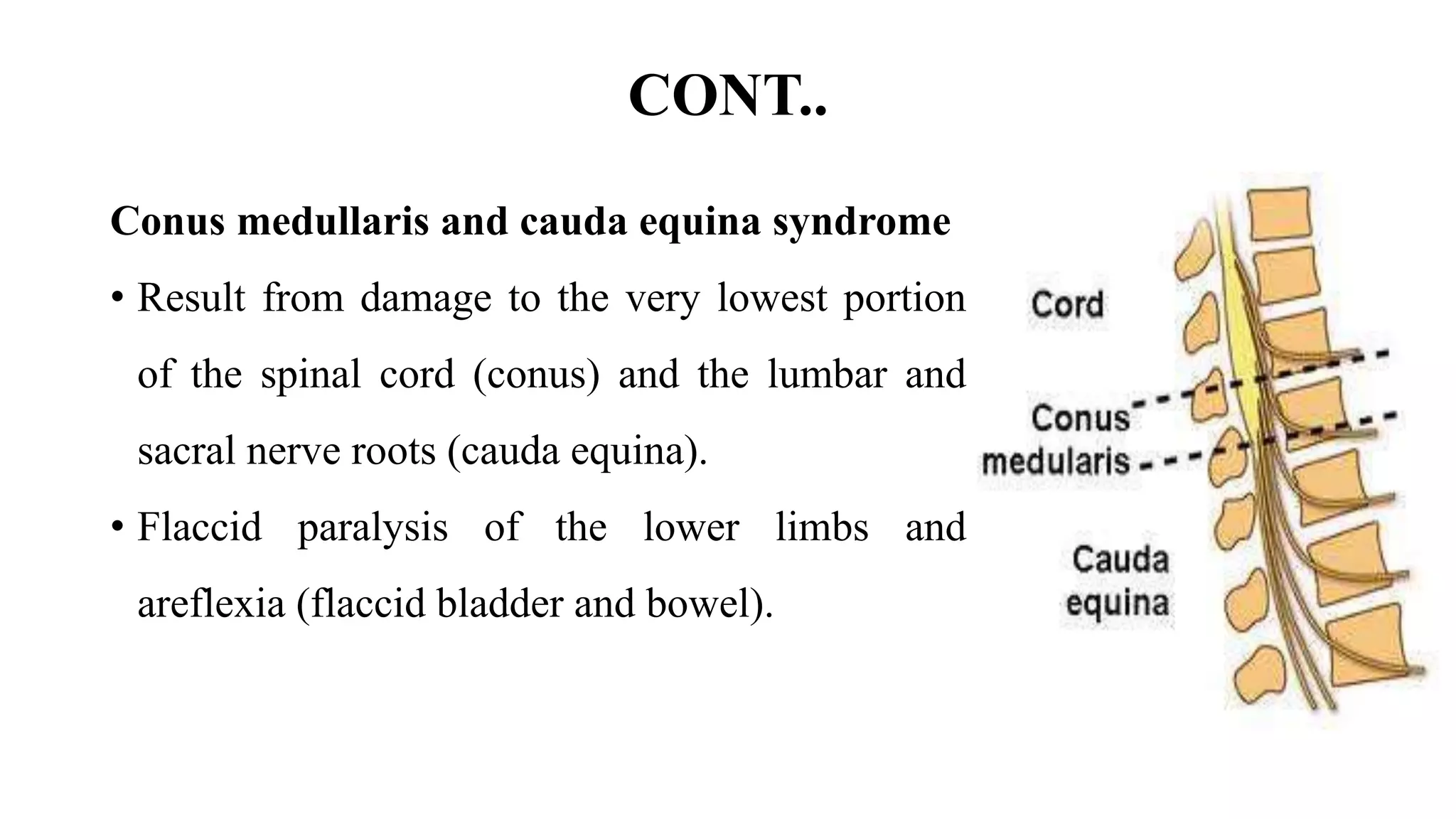 Spinal cord injury_040036.pptx | Death, Injury, or Military Conflict ...