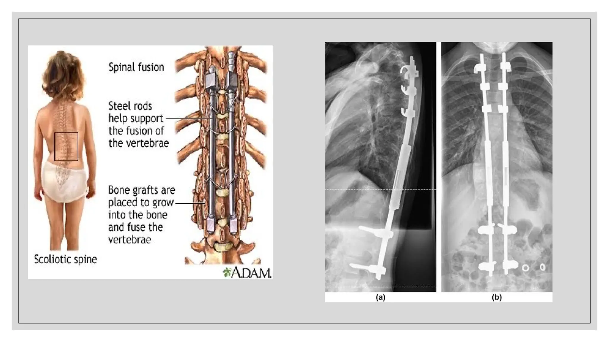 Krishna mittal SCI | PPT