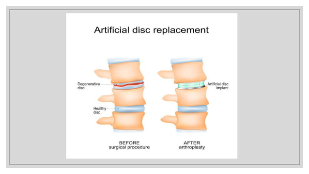 Krishna mittal SCI | PPT