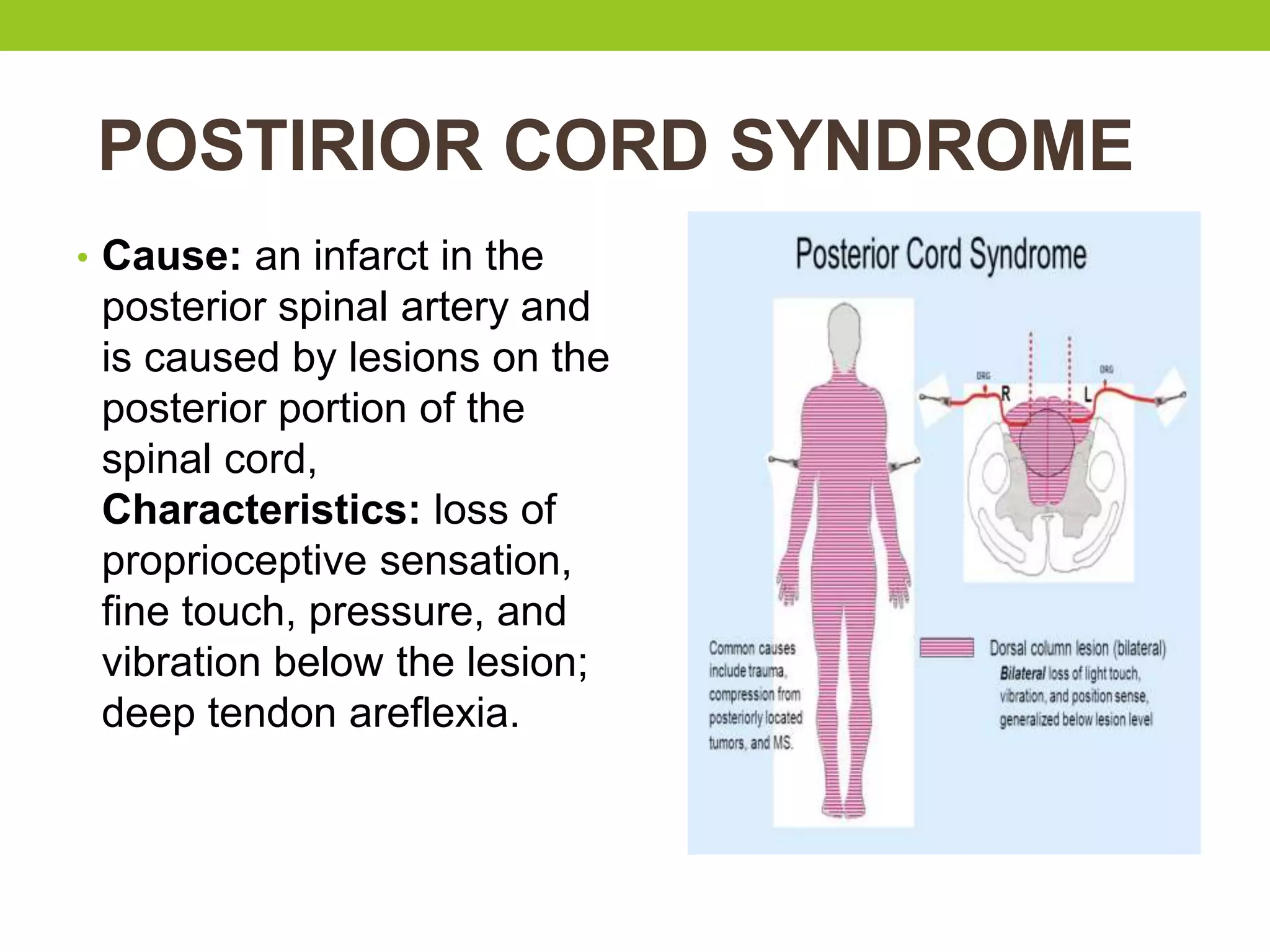 Spinal cord injury (SCI) | PPTX