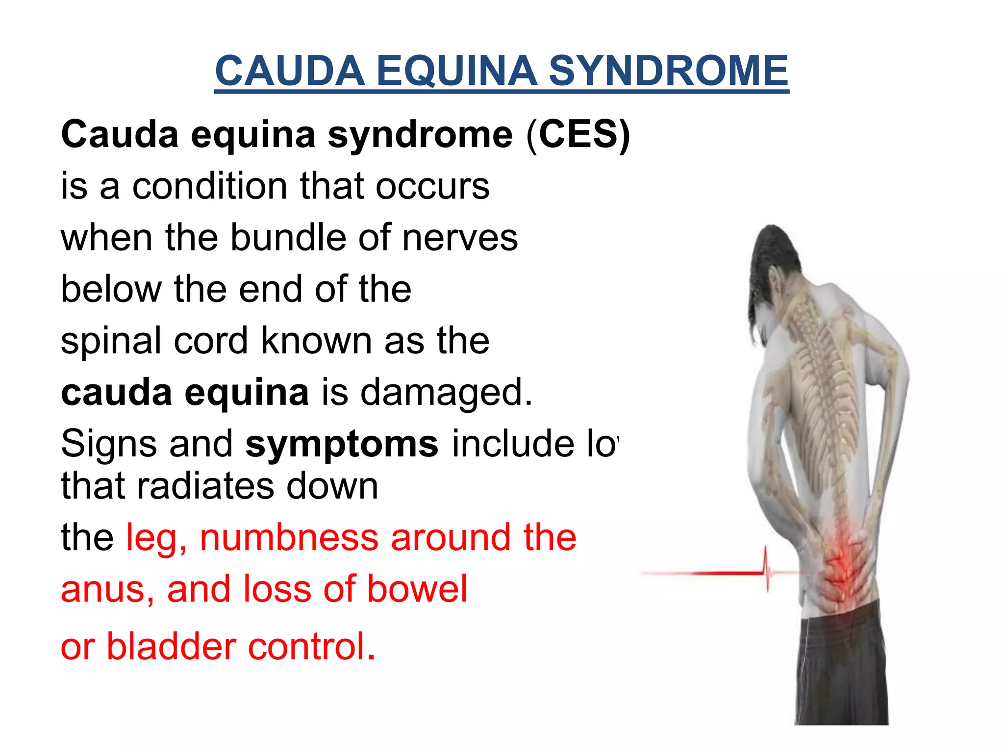 Spinal Cord Injuries | PPTX