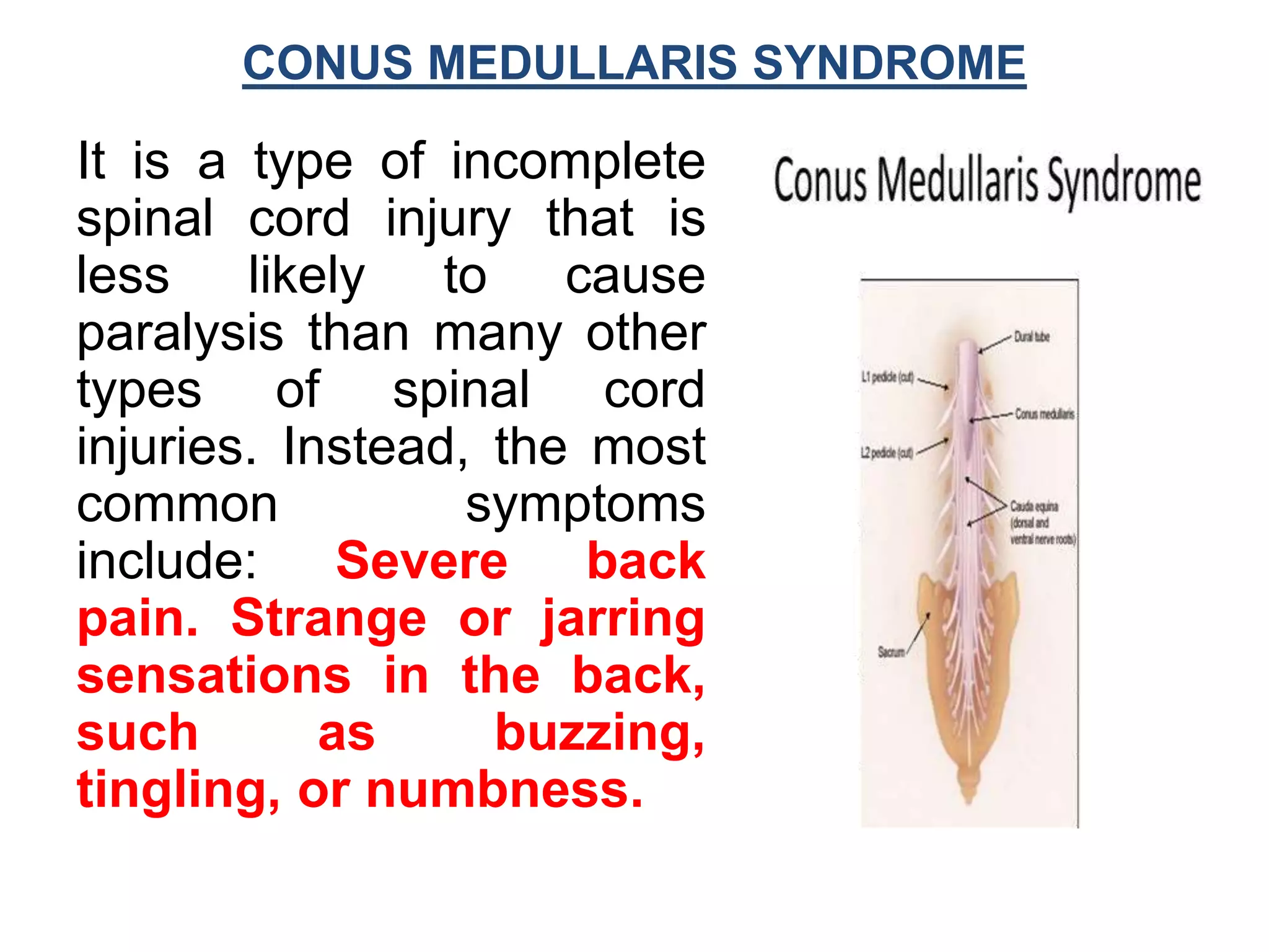 Spinal Cord Injuries | PPTX
