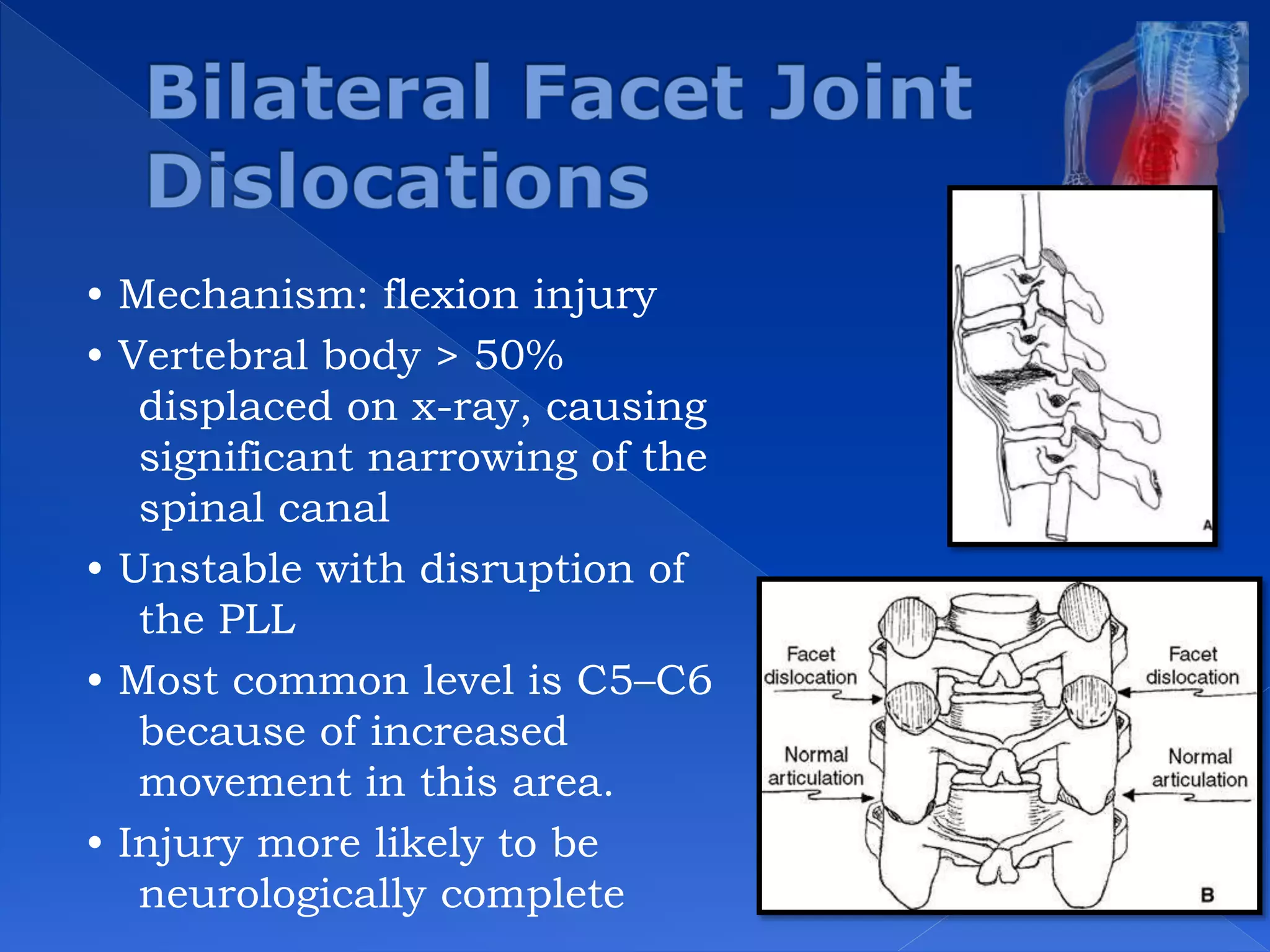 Spinal cord injury rehabilitation | PPTX