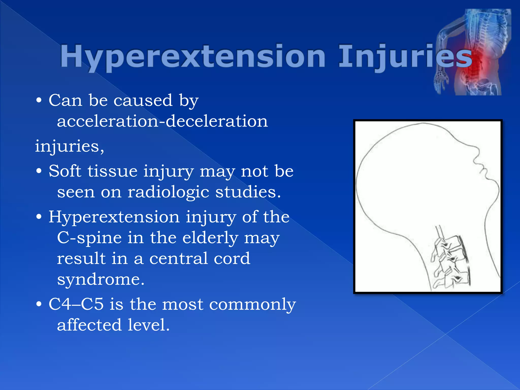 Spinal cord injury rehabilitation | PPTX
