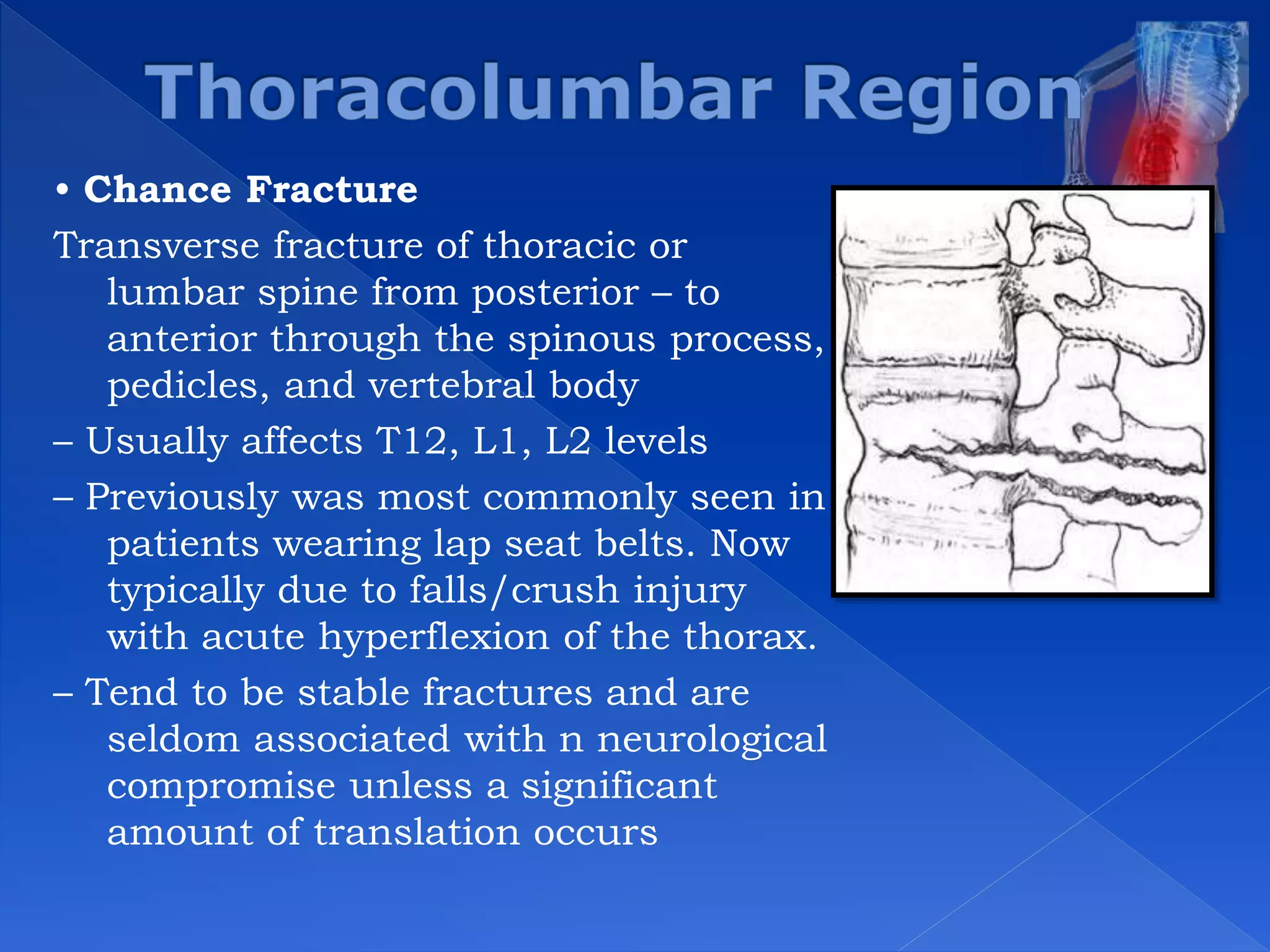 Spinal cord injury rehabilitation | PPTX