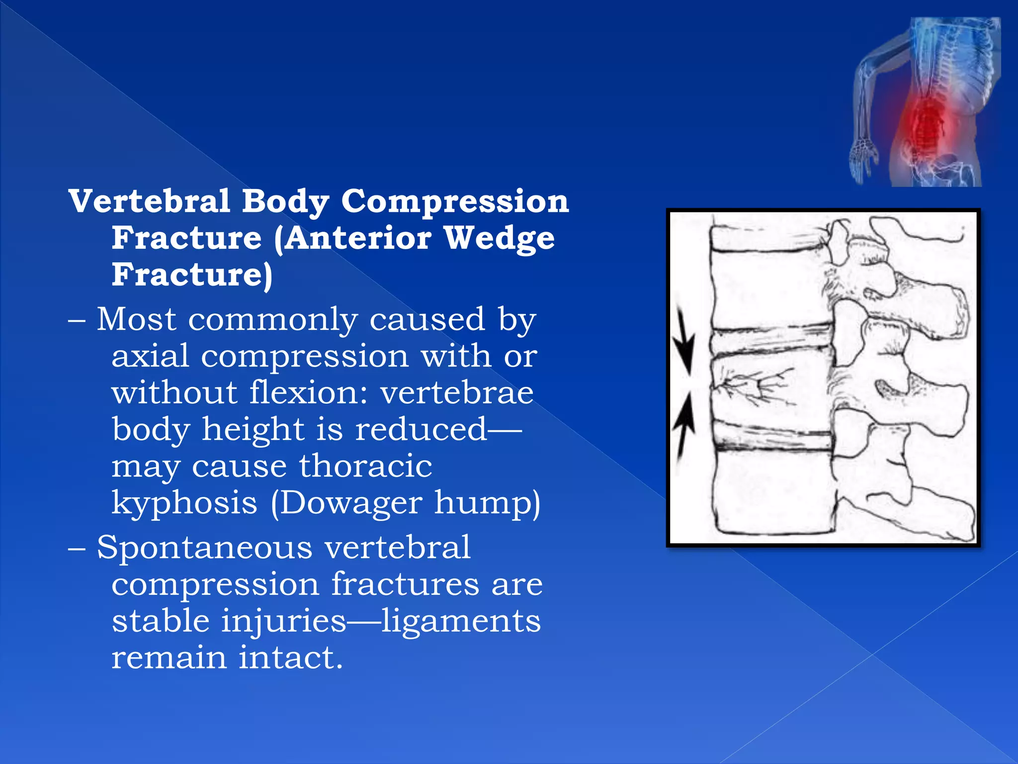 Spinal cord injury rehabilitation | PPTX