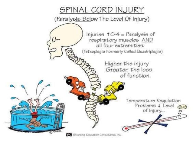 Spinal Cord Injury (SCI)