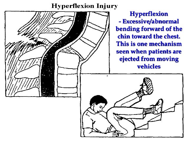 Spinal Cord Injury (SCI)