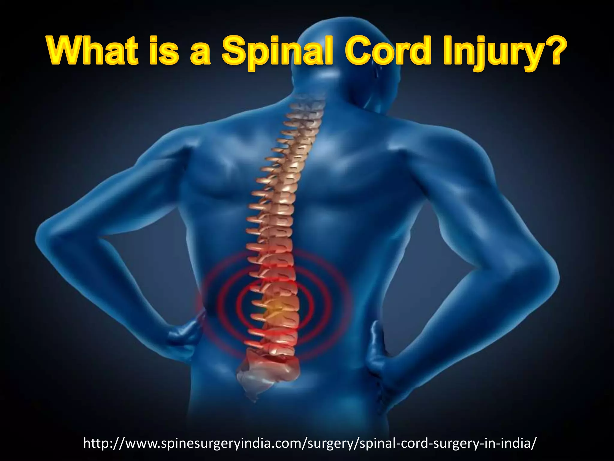 Spinal cord injury & treatment | PPTX