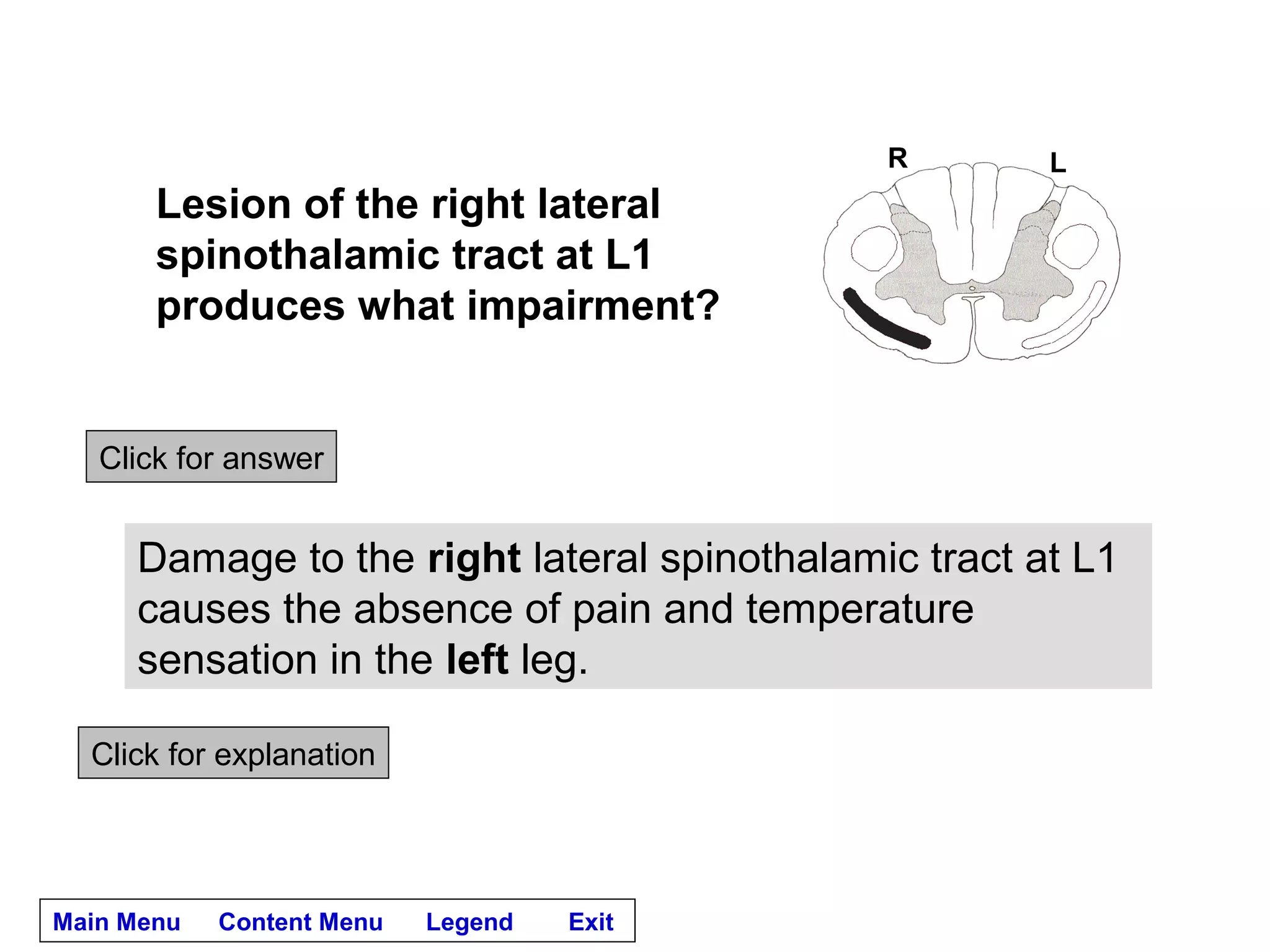 Spinal cord lesions module | PPS