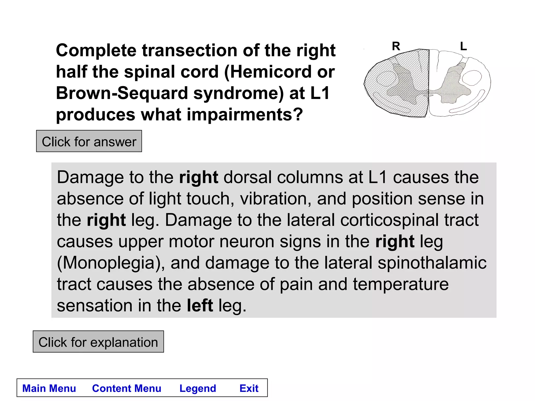 Spinal cord lesions module | PPS