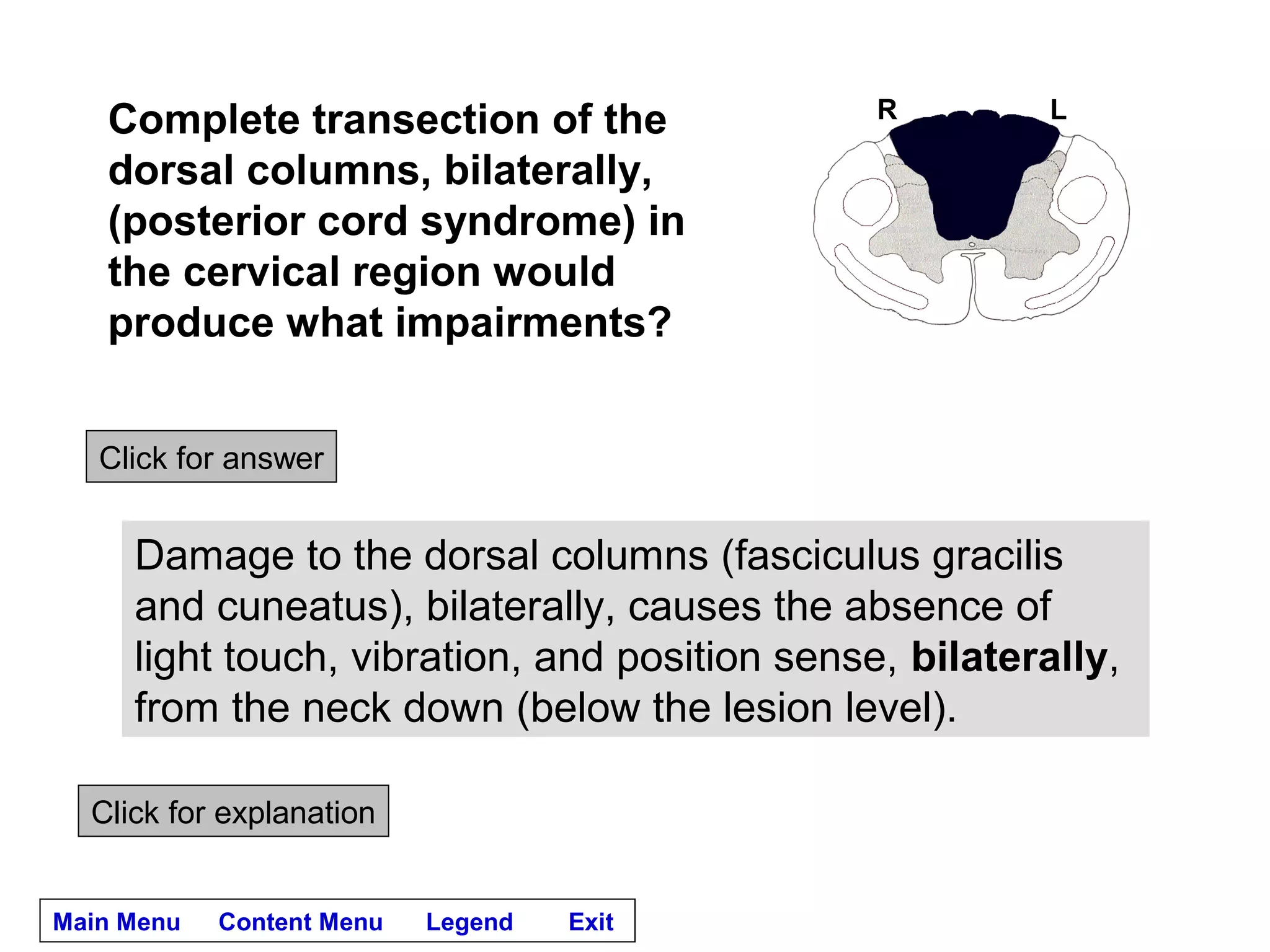 Spinal cord lesions module | PPS