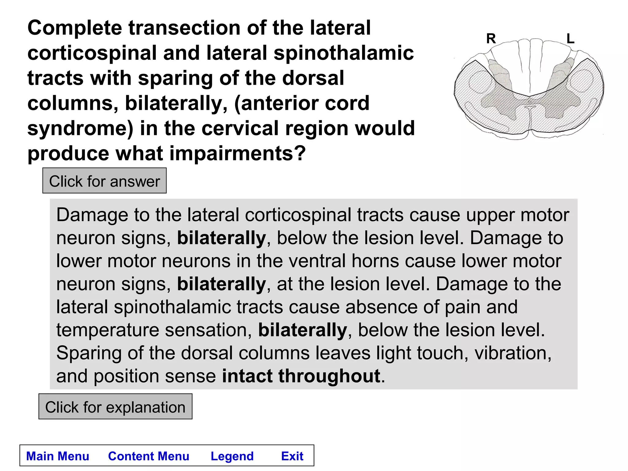 Spinal cord lesions module | PPS