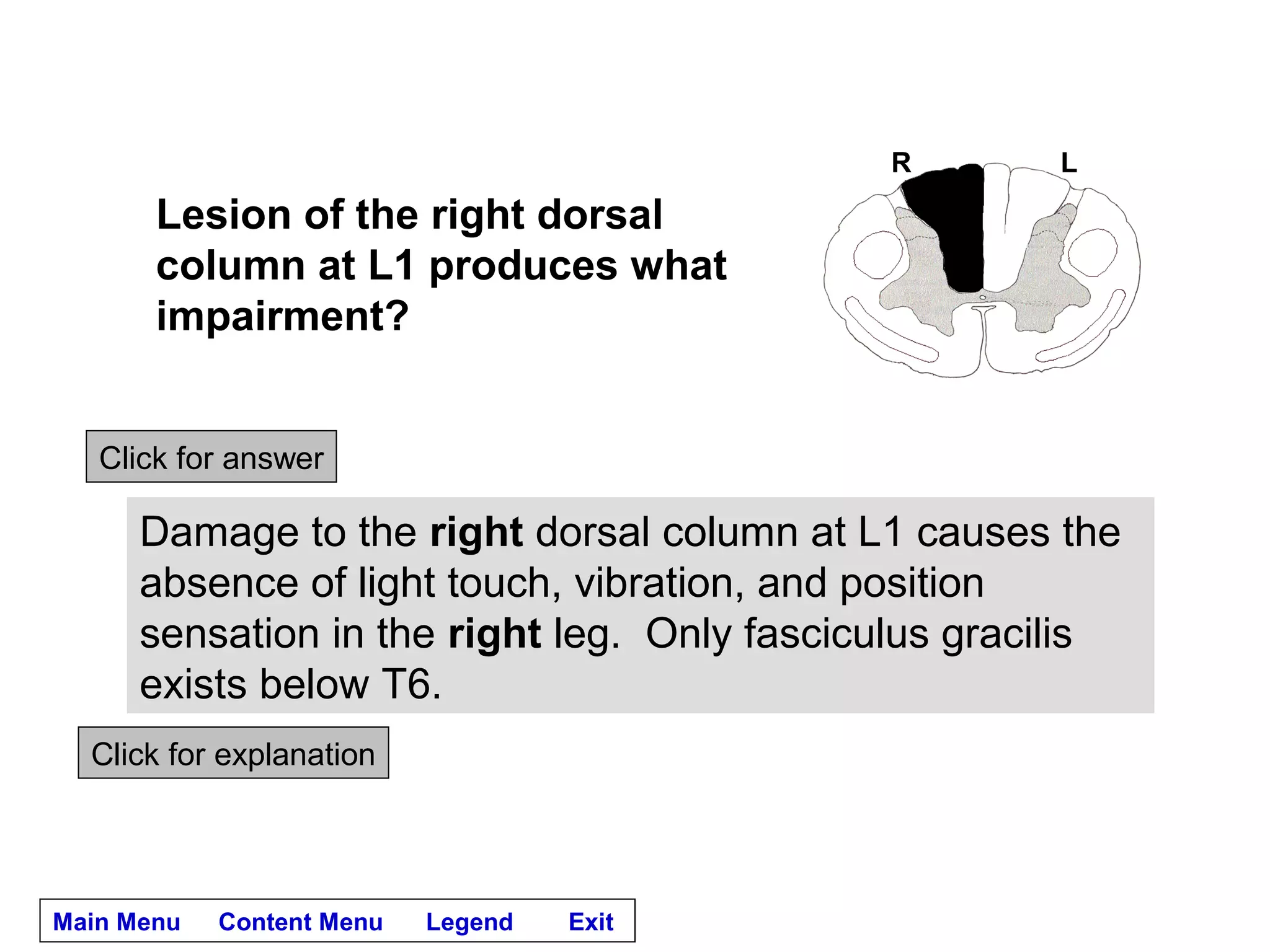 Spinal cord lesions module | PPS