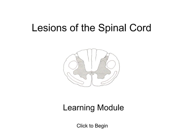 Spinal cord lesions module | PPS | Death, Injury, or Military Conflict ...