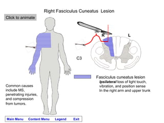 Spinal cord lesions module | PPS