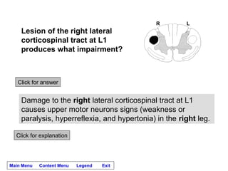 Spinal cord lesions module | PPS
