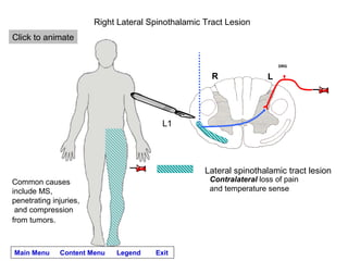 Spinal cord lesions module | PPS