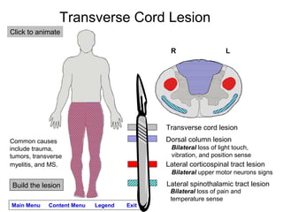 Spinal cord lesions module | PPS